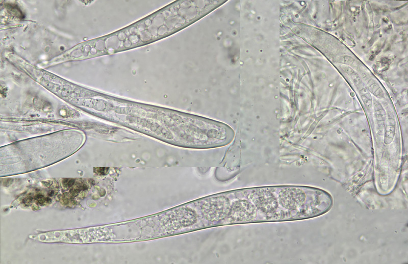 Claussenomyces atrovirens (Voskovička)
